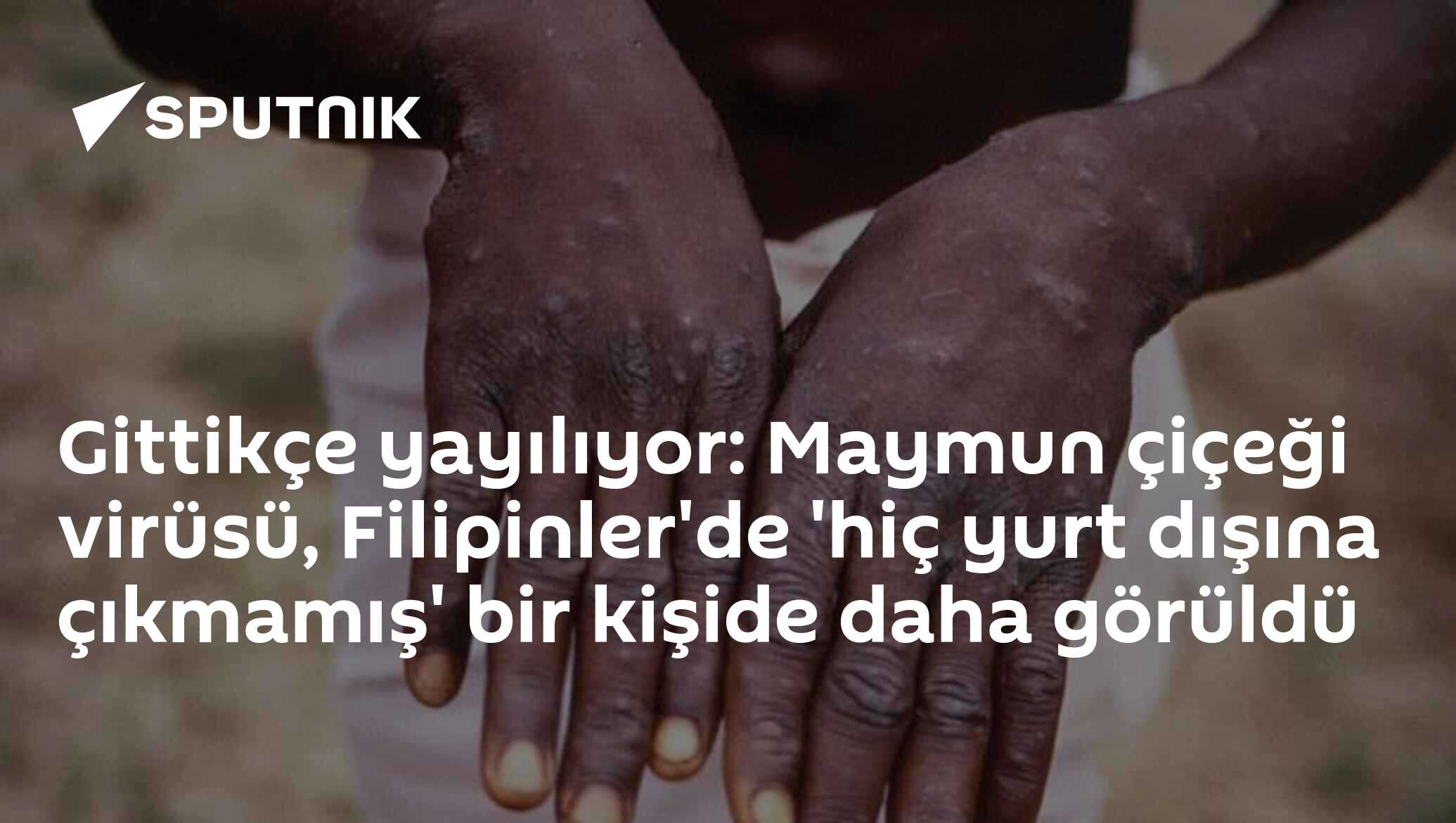 Gittikçe yayılıyor: Maymun çiçeği virüsü, Filipinler'de 'hiç yurt ...